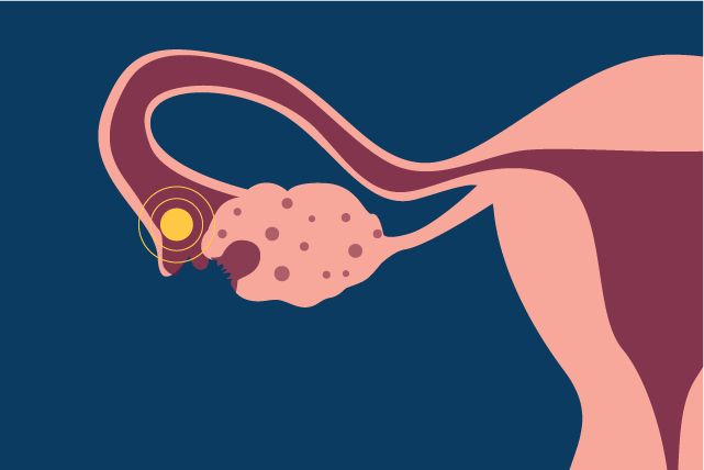 Ovulatory Cycle V’s Anovulatory Cycle – Enhance Wellness